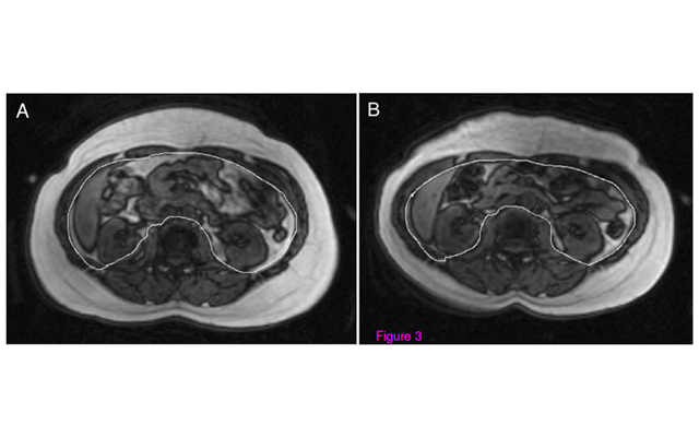 Isagenix Clinical Study in 2nd Journal - Isagenix Health