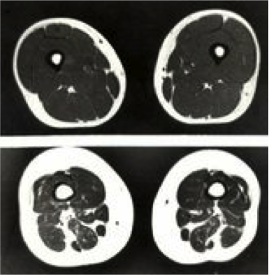MRI-of-visceral-fat - Isagenix Health